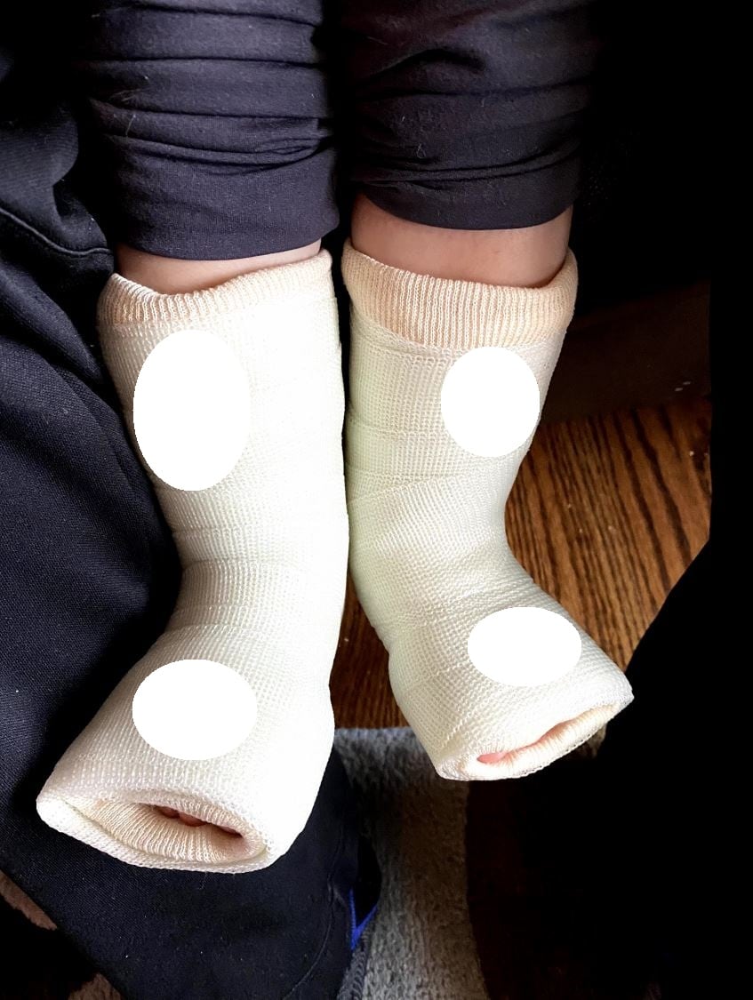 Idiopathic Toe Walking & Pediatric Therapy - Milestone Therapy Blog