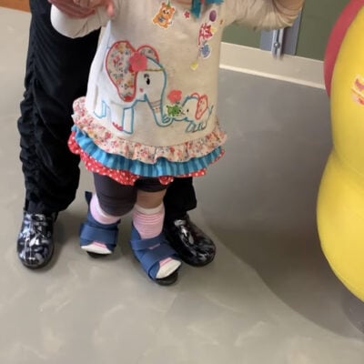 Learn about pediatric serial casting - Milestone Therapy